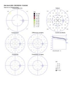 Qu’est ce que l’examen du champ visuel